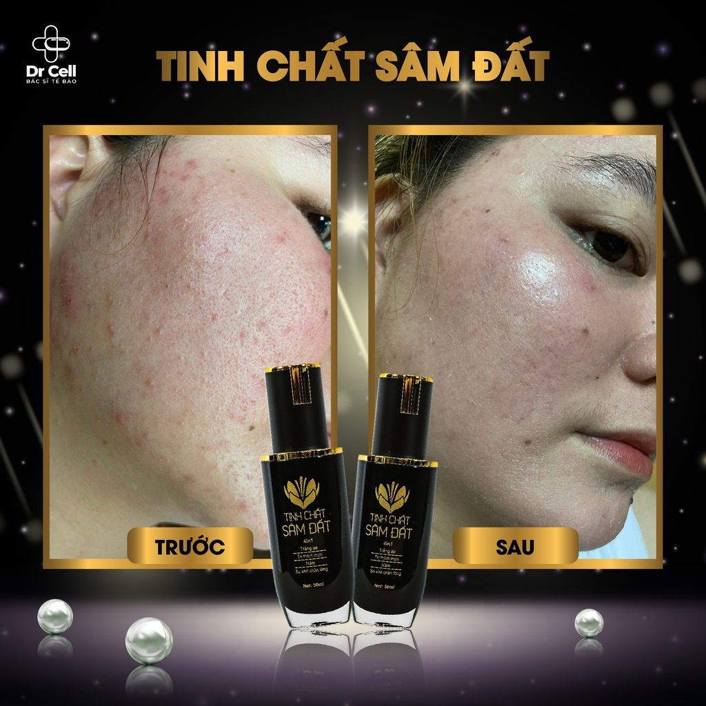 7 thói quen hết mụn hiệu quả và làm đẹp từ bên trong – Mỹ phẩm Drcell