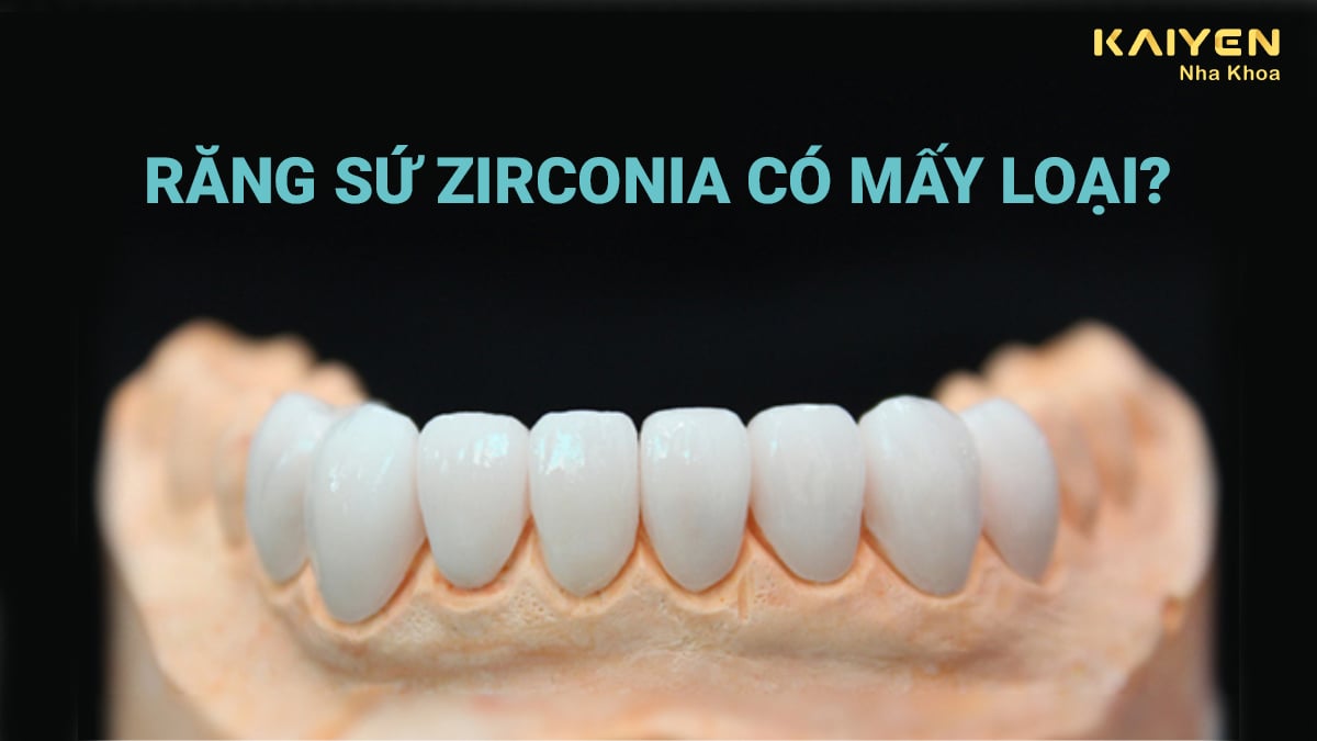 Các răng sứ zirconia có mấy loại được sử dụng phổ biến trong nha khoa