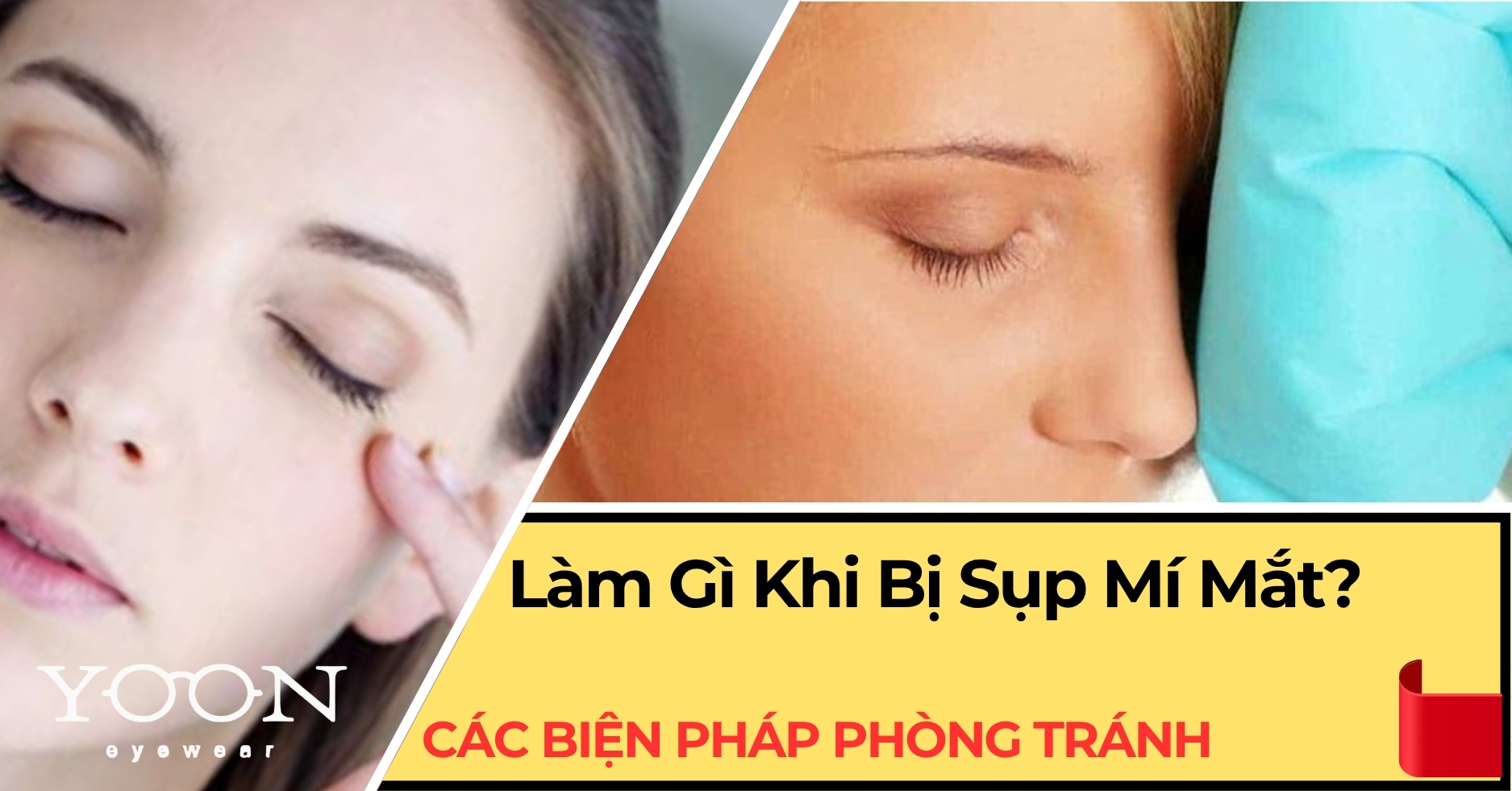 Làm Gì Khi Bị Sụp Mí Mắt Mỗi Sáng? Mẹo Đơn Giản, Dễ Thực Hiện – Yoon