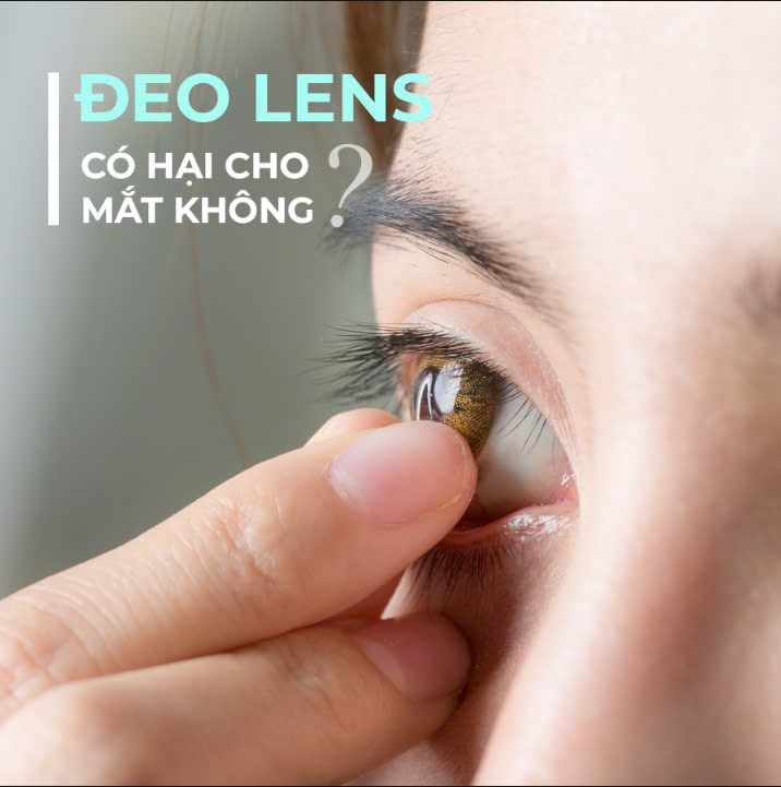 ĐEO LENS CÓ HẠI CHO MẮT KHÔNG?CÁCH VỆ SINH LENS ĐÚNG VÀ AN TOÀN? – Kính ...