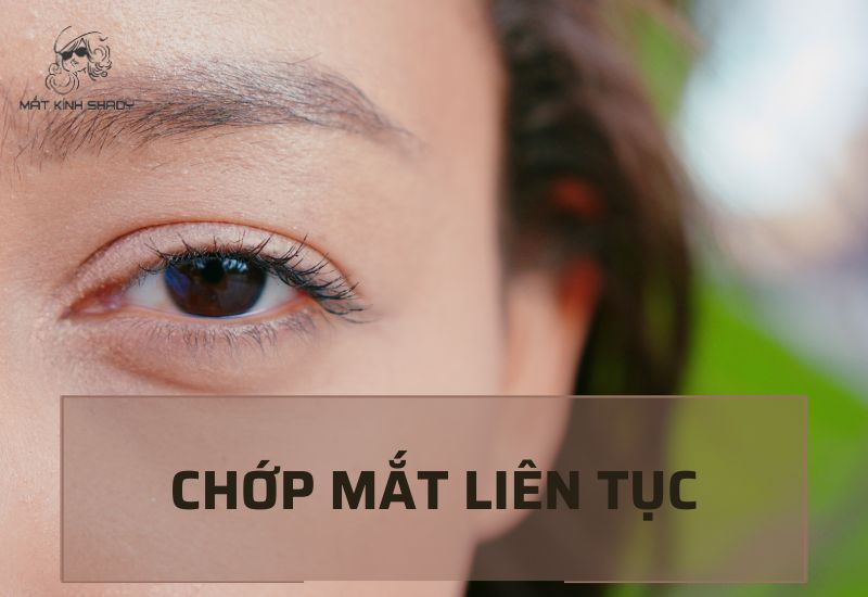 Chớp mắt liên tục có đáng lo ngại không?