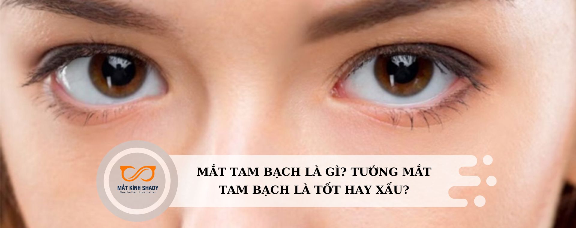 Mắt tam bạch là gì? Tướng mắt tam bạch là tốt hay xấu?