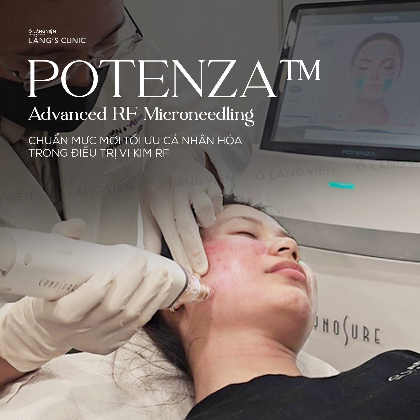 POTENZA RF MICRONEEDLING - Chuẩn mực mới trong điều trị vi kim RF – Ồ ...