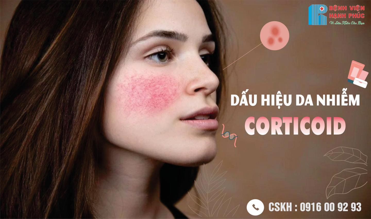 DẤU HIỆU DA NHIỄM CORTICOID – BỆNH VIỆN ĐA KHOA HẠNH PHÚC AN GIANG