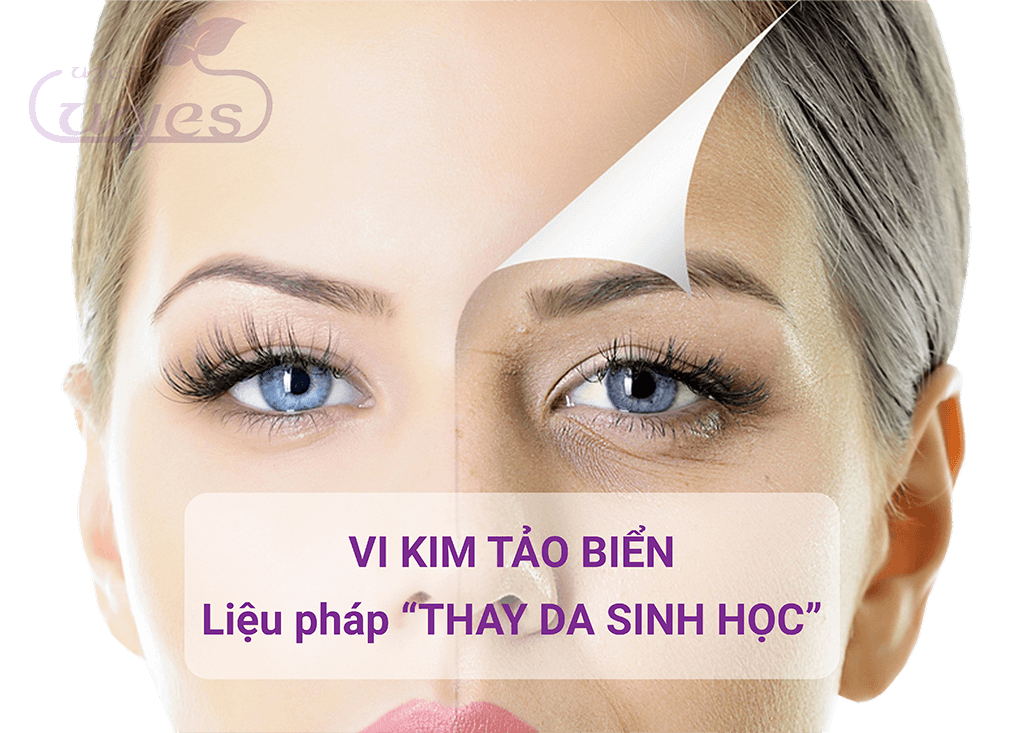 Vi kim tảo biển – Hộ Kinh Doanh Song Đan