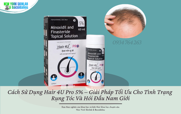 Cách Sử Dụng Hair 4U Pro 5% – Giảm Rụng Tóc, Hói Đầu Hiệu Quả – New ...