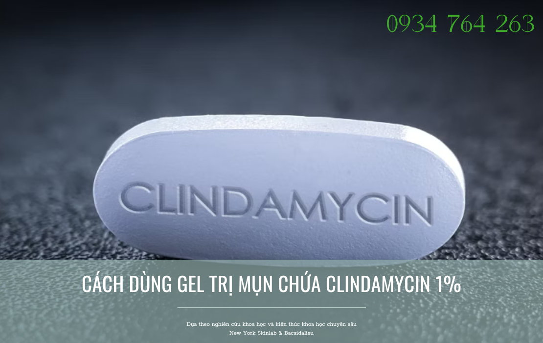 Gel Trị Mụn Clindamycin 1% – Hiệu Quả & Kết Hợp Chuẩn – New York ...