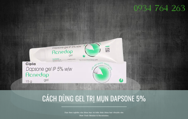 Hướng Dẫn Dùng Dapsone 5% & Dapsone Plus Trị Mụn Hiệu Quả – New York ...