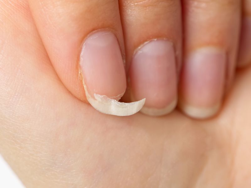 Tại sao móng tay dễ gãy? Nguyên nhân và cách khắc phục – Kềm Nghĩa ...