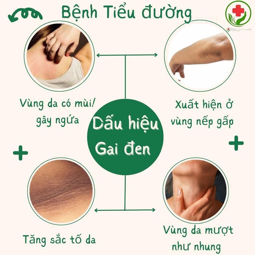 DẤU HIỆU GAI ĐEN Ở BỆNH TIỂU ĐƯỜNG – ROLIE Việt Nam