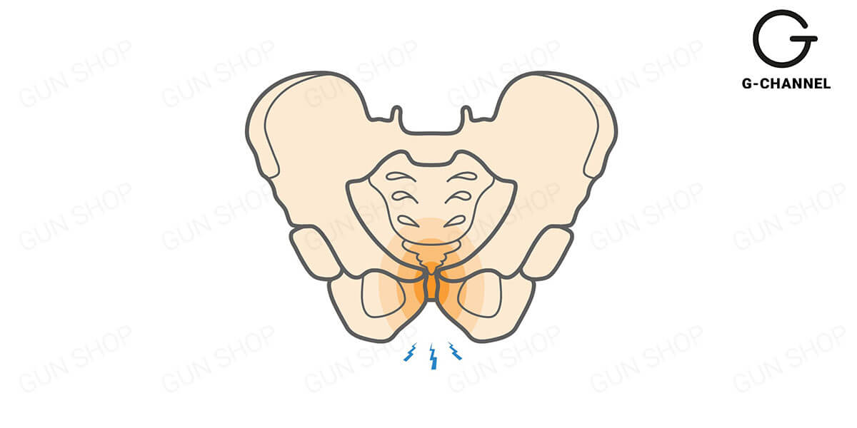 Điều trị và cách khắc phục xương mu cao hiệu quả nhất