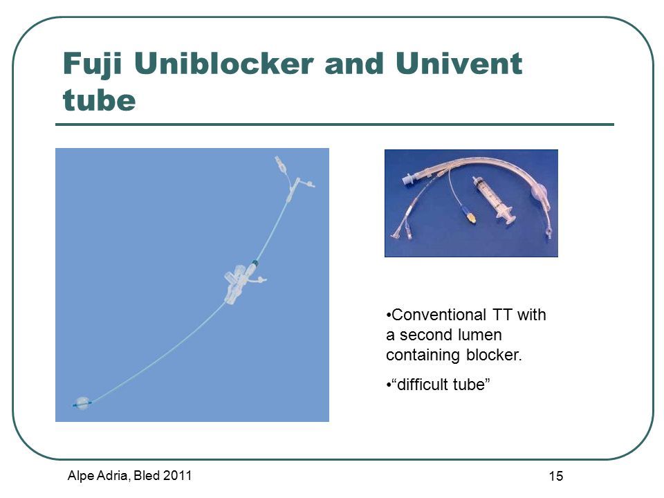 Ống cô lập phổi loại mới, dễ dàng làm xẹp từng bên hoặc phân thuỳ phổi ...