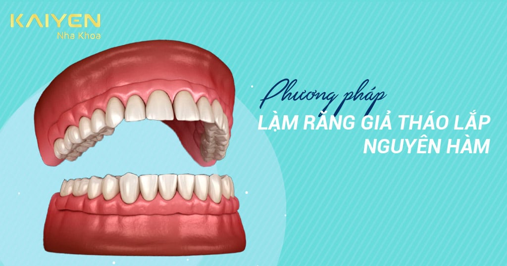 Hướng dẫn răng giả nguyên hàm đúng cách và nhanh nhất