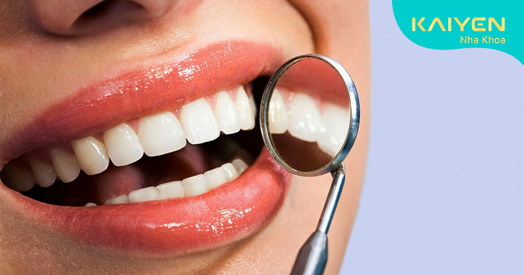 Cách có một hàm răng đều đẹp răng đều đẹp đơn giản tại nhà