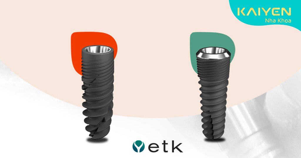 Trụ Implant ETK – Xuất xứ, cấu tạo và ưu điểm – Nha khoa Quốc Tế KAIYEN