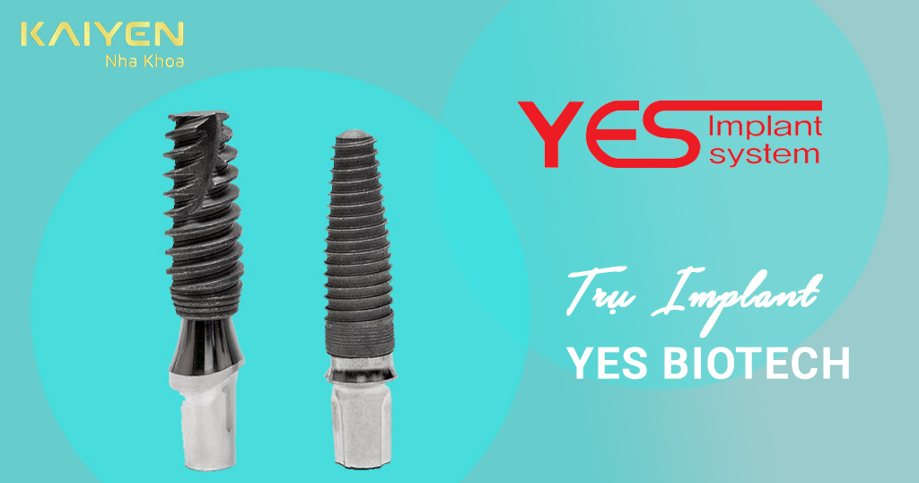 Trụ Implant Yes Biotech: Xuất xứ, cấu tạo và những ưu điểm nổi bật ...