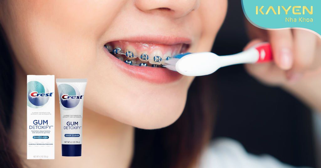 [Tham khảo] TOP 7 kem đánh răng cho người niềng răng được khuyên dùng ...