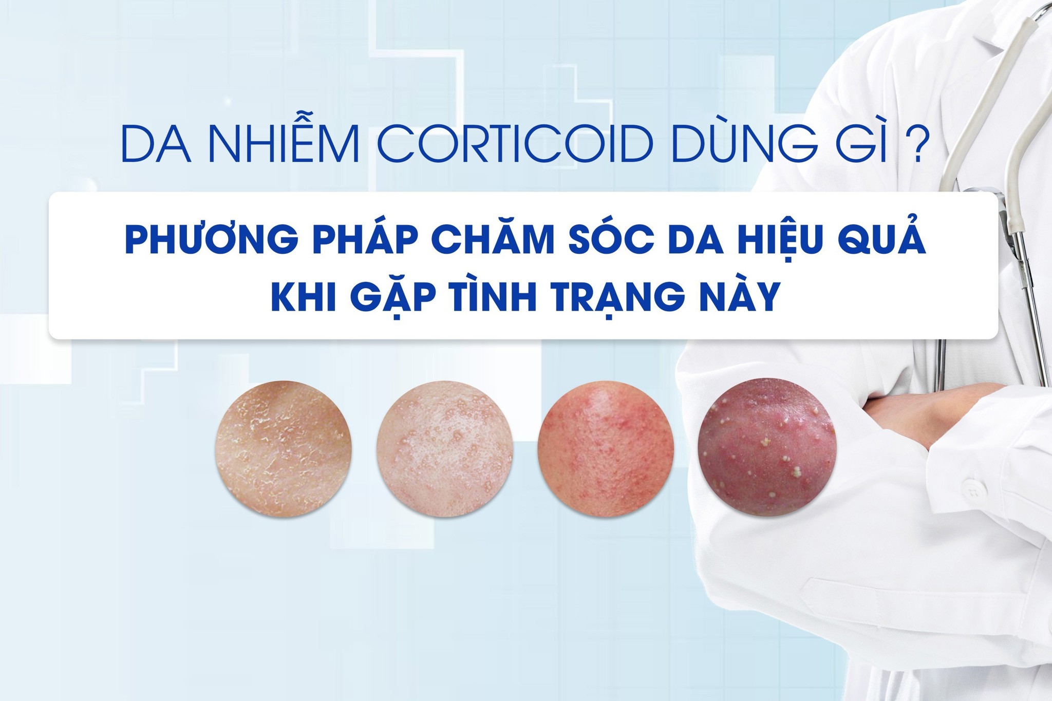 DA NHIỄM CORTICOID DÙNG GÌ: PHƯƠNG PHÁP CHĂM SÓC DA HIỆU QUẢ – AHOHWA ...