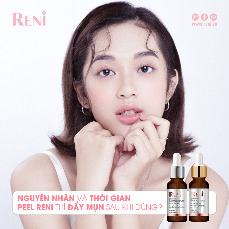 NGUYÊN NHÂN VÀ THỜI GIAN PEEL RENI ĐẨY MỤN SAU KHI DÙNG – Reni Cosmetics