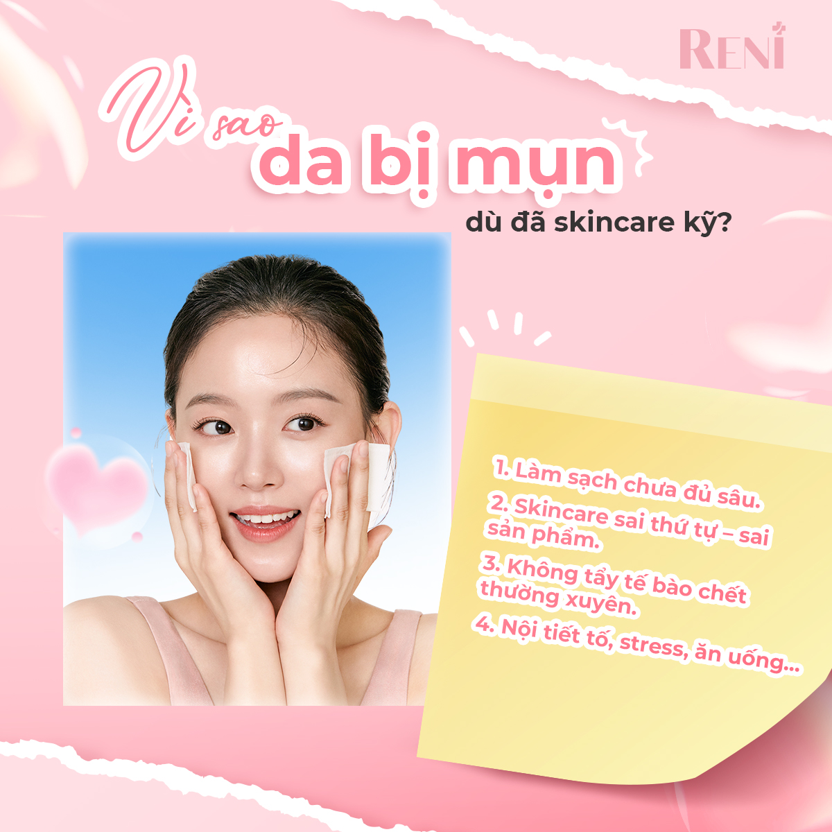 VÌ SAO DA VẪN BỊ MỤN DÙ ĐÃ SKINCARE RẤT KỸ? – Reni Cosmetics