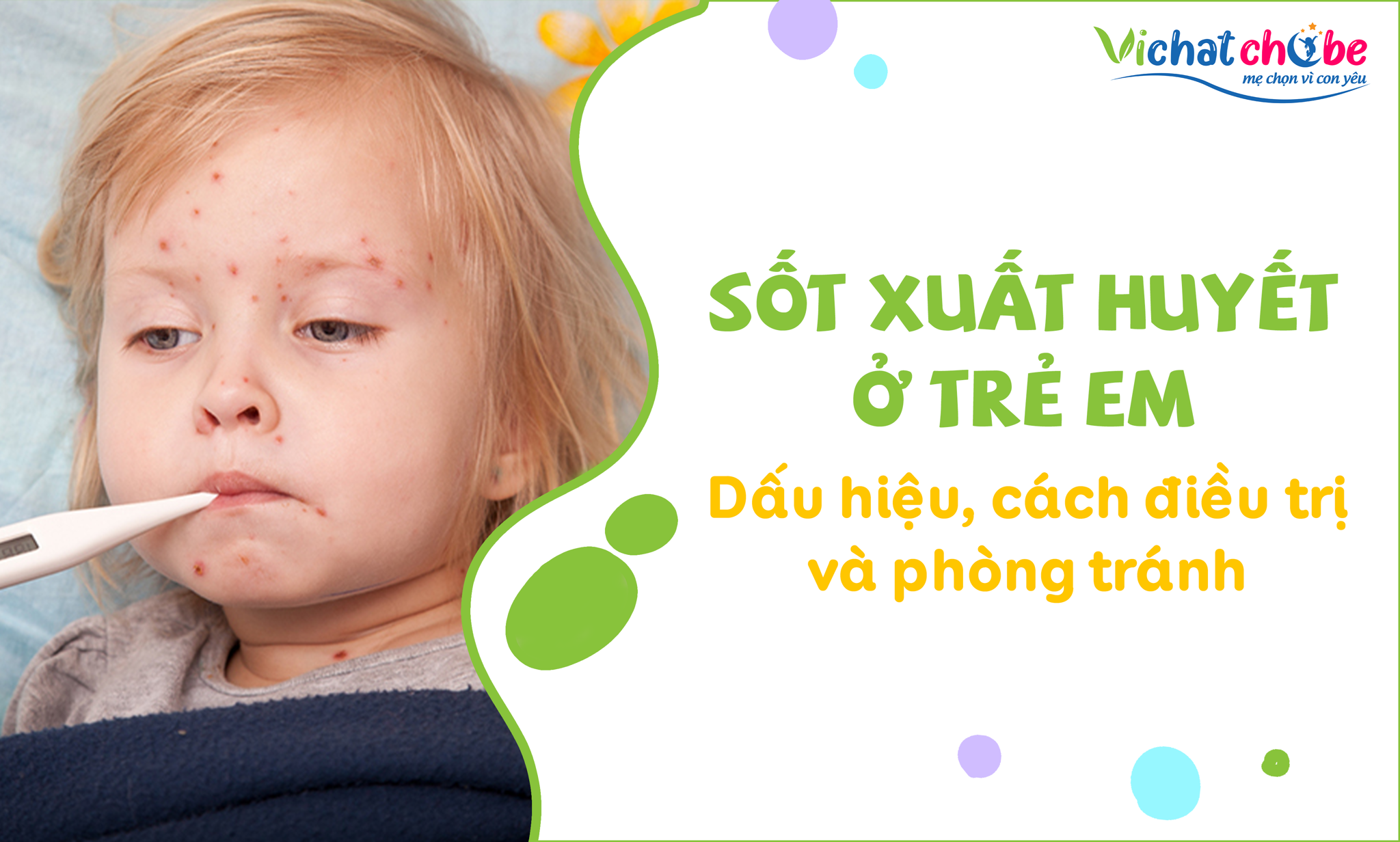Sốt Xuất Huyết Ở Trẻ Em: Dấu Hiệu Cách Điều Trị Và Phòng Tránh