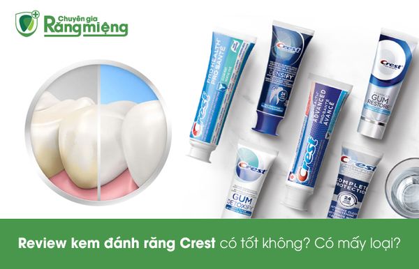 Review Các Loại Kem Đánh Răng Crest Hiện Nay, Loại Nào Trắng Nhất?
