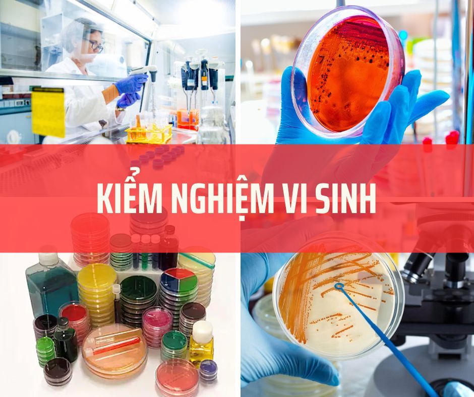 Kiểm nghiệm vi sinh – Trung Tâm Đào Tạo và Phát Triển Sắc Ký (EDC-HCM)