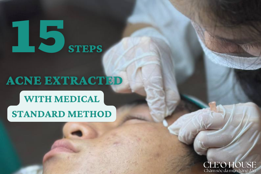 15 STEPS: ACNE EXTRACTED WITH MEDICAL STANDARD METHOD AT CLE’O HOUSE ...