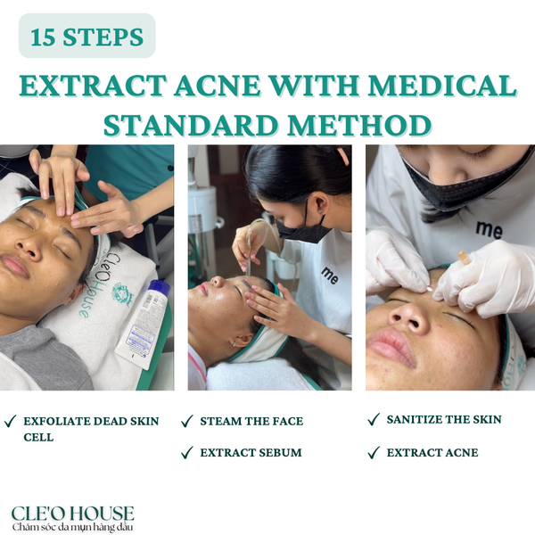 15 STEPS: ACNE EXTRACTED WITH MEDICAL STANDARD METHOD AT CLE’O HOUSE ...