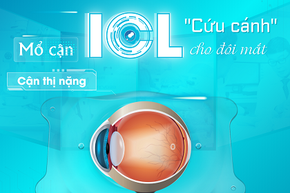 Mổ cận ICL: "Cứu cánh" cho đôi mắt cận thị nặng, giác mạc mỏng – Hai ...