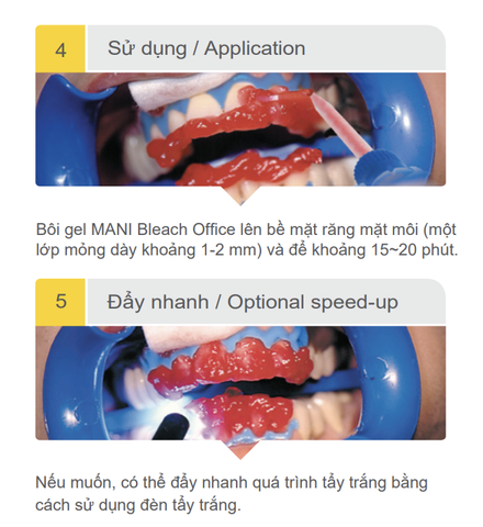Tẩy trắng Mani Bleach 'n Shine - Đức Thiện Medical – ĐỨC THIỆN MEDICAL