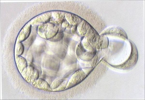 Learn About Embryo Culture In IVF ivfholymothers
