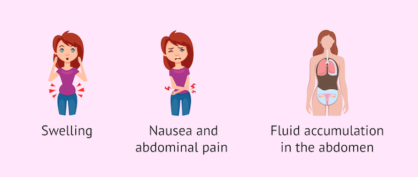 Ovarian Hyperstimulation Syndrome (OHSS) ivfholymothers
