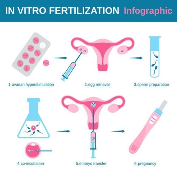 How to Prepare for a Successful IVF Cycle ivfholymothers