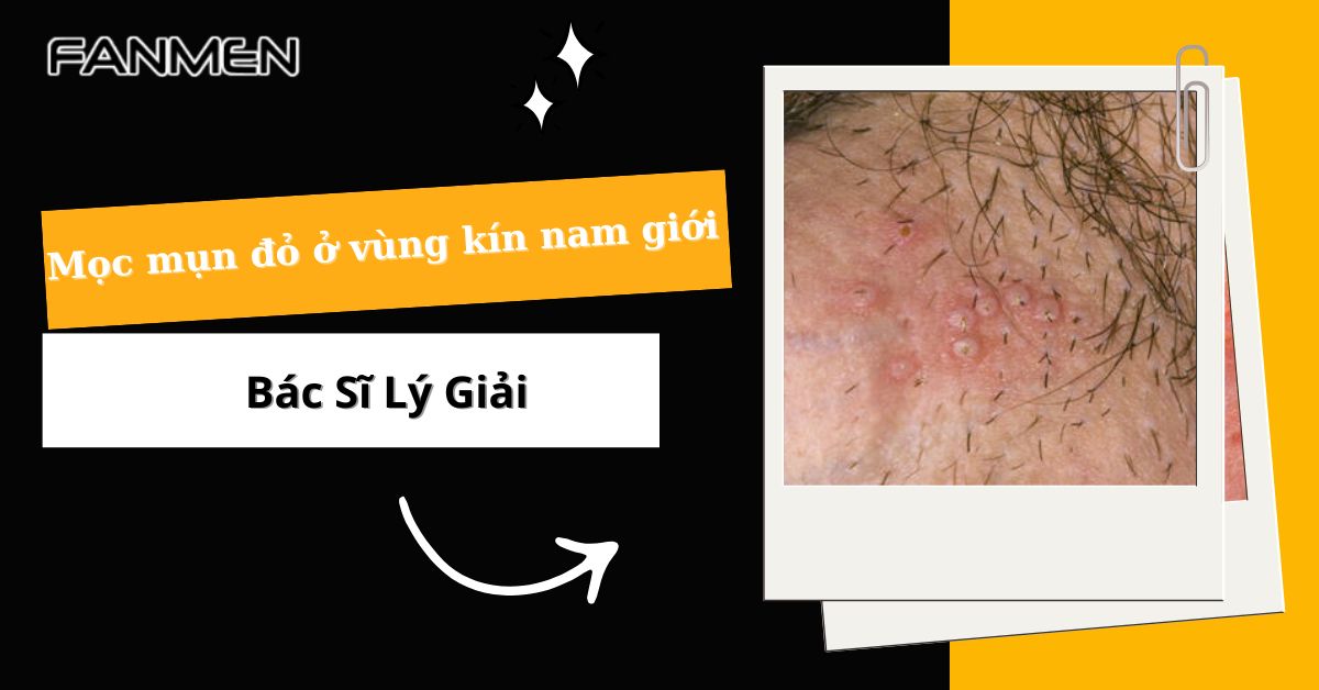 Cảnh Báo: Mọc Mụn Đỏ Ở Vùng Kín Nam Giới “bác Sĩ Lý Giải” – Fanmen