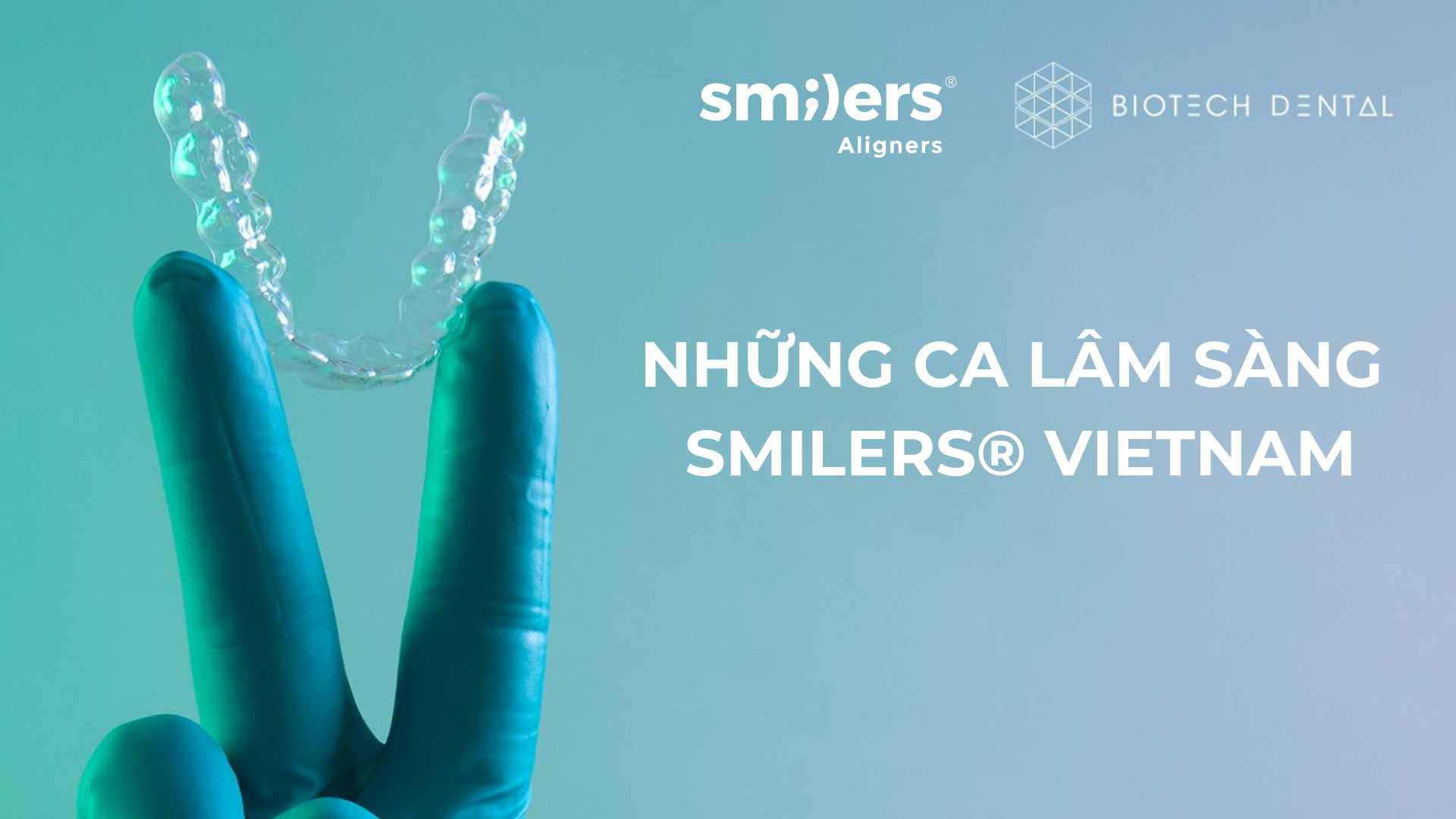 KẾT QUẢ LÂM SÀNG VỚI KHAY CHỈNH NHA TRONG SUỐT SMILERS® TẠI VIỆT NAM ...
