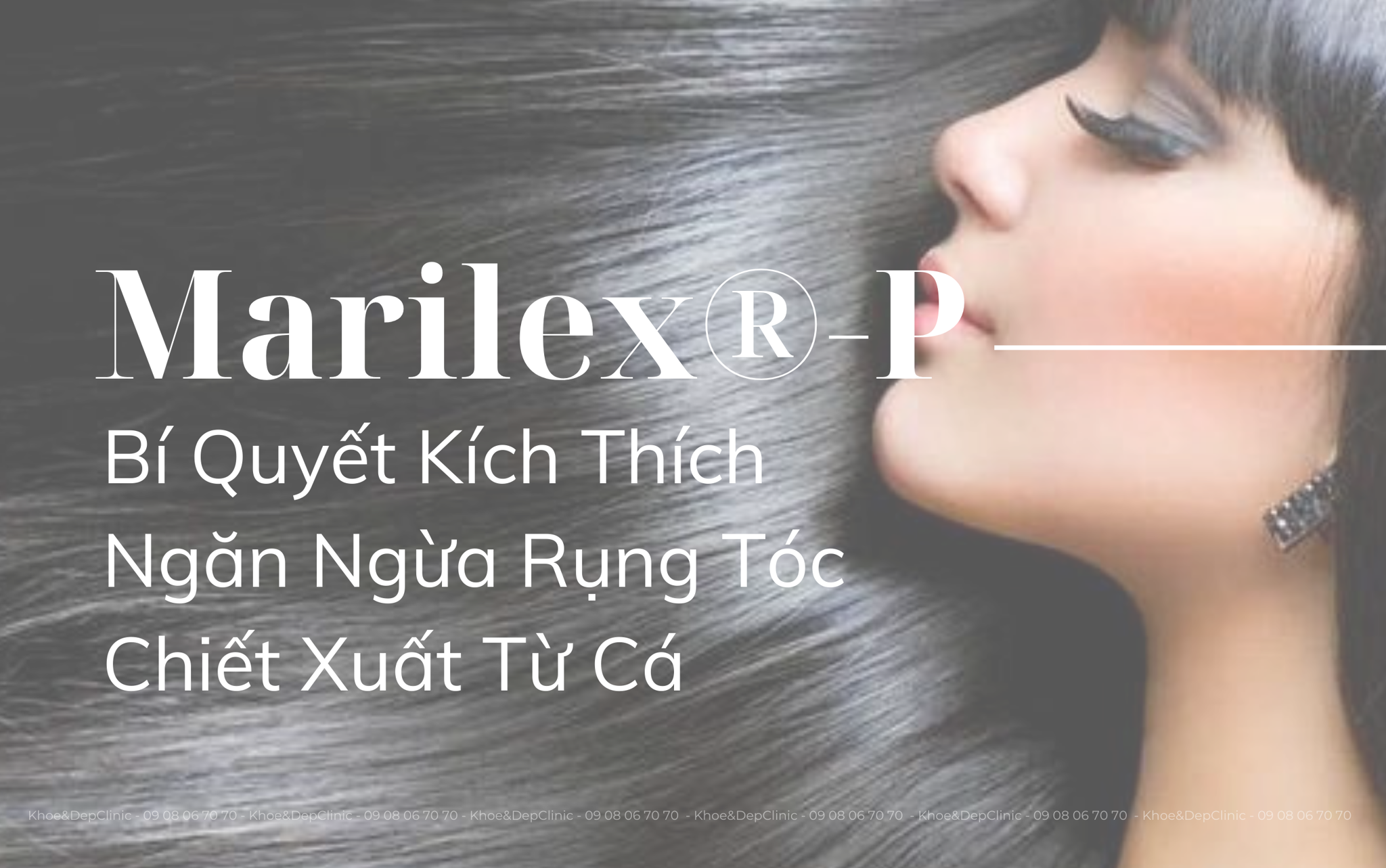 Marilex®-P: Bí Quyết Kích Thích & Ngăn Ngừa Rụng Tóc Chiết Xuất Từ Cá ...