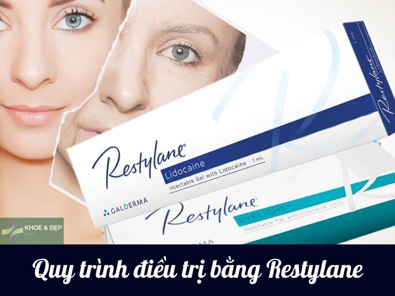 Filler Restylane của nước nào? Giá bao nhiêu tiền 1cc? – KHOẺ & ĐẸP CLINIC