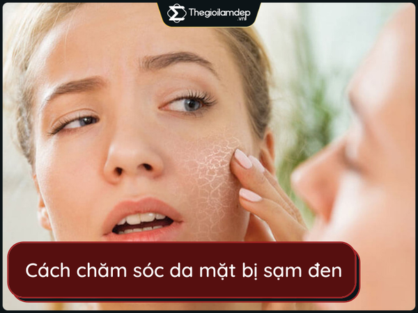 Cách chăm sóc da mặt bị sạm đen an toàn và hiệu quả nhất