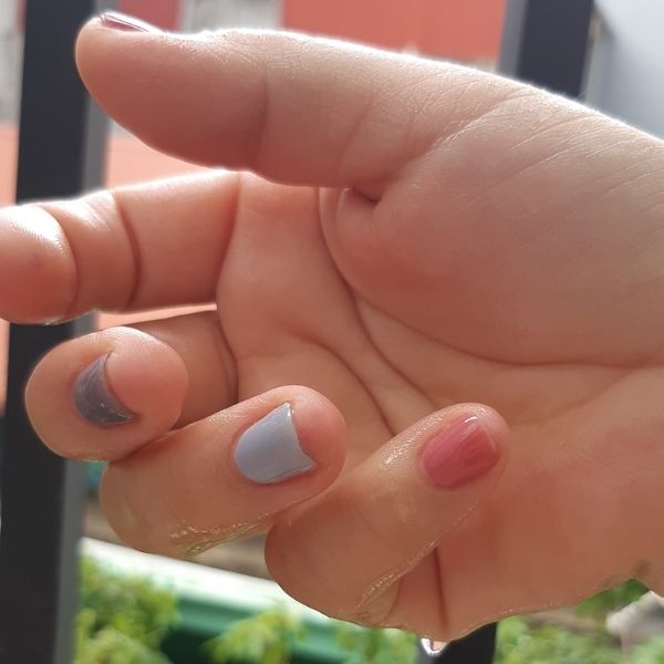 Pasma là gì? Tìm Hiểu Mối Liên Hệ Với Chứng Tăng Tiết Mồ Hôi