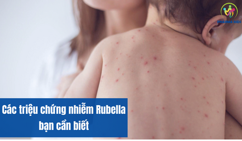 Rubella và những điều bạn cần biết – Pharmakids