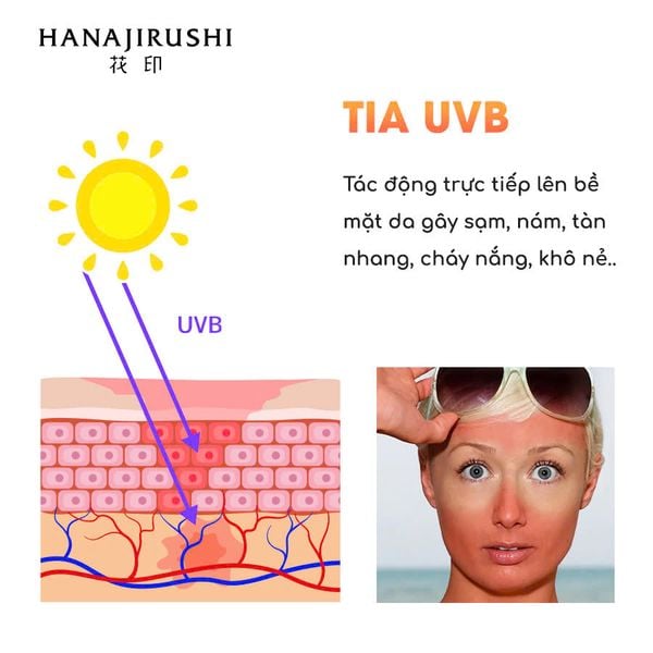 Tia UV là gì? Phân biệt các loại tia UVA, UVB và UVC – HANAJIRUSHI