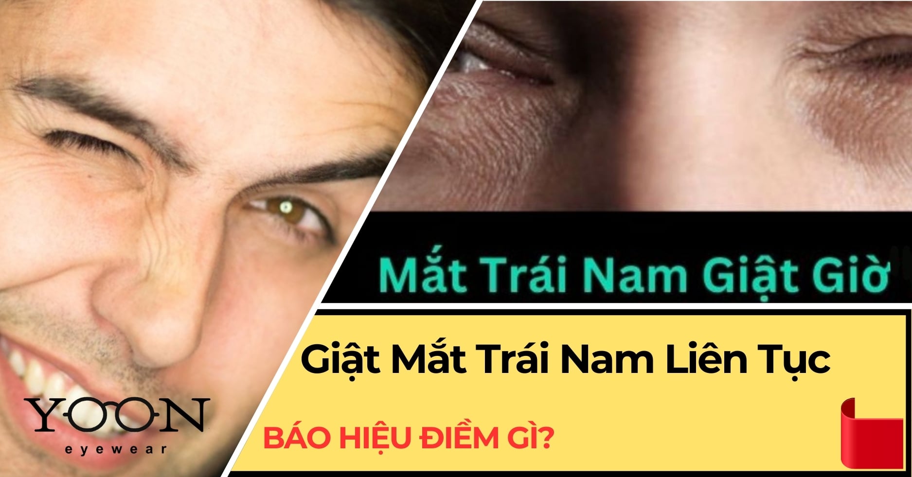 Giật Mắt Trái Nam Liên Tục Báo Điềm Gì? Giải Đáp Điềm Báo Theo Giờ ...