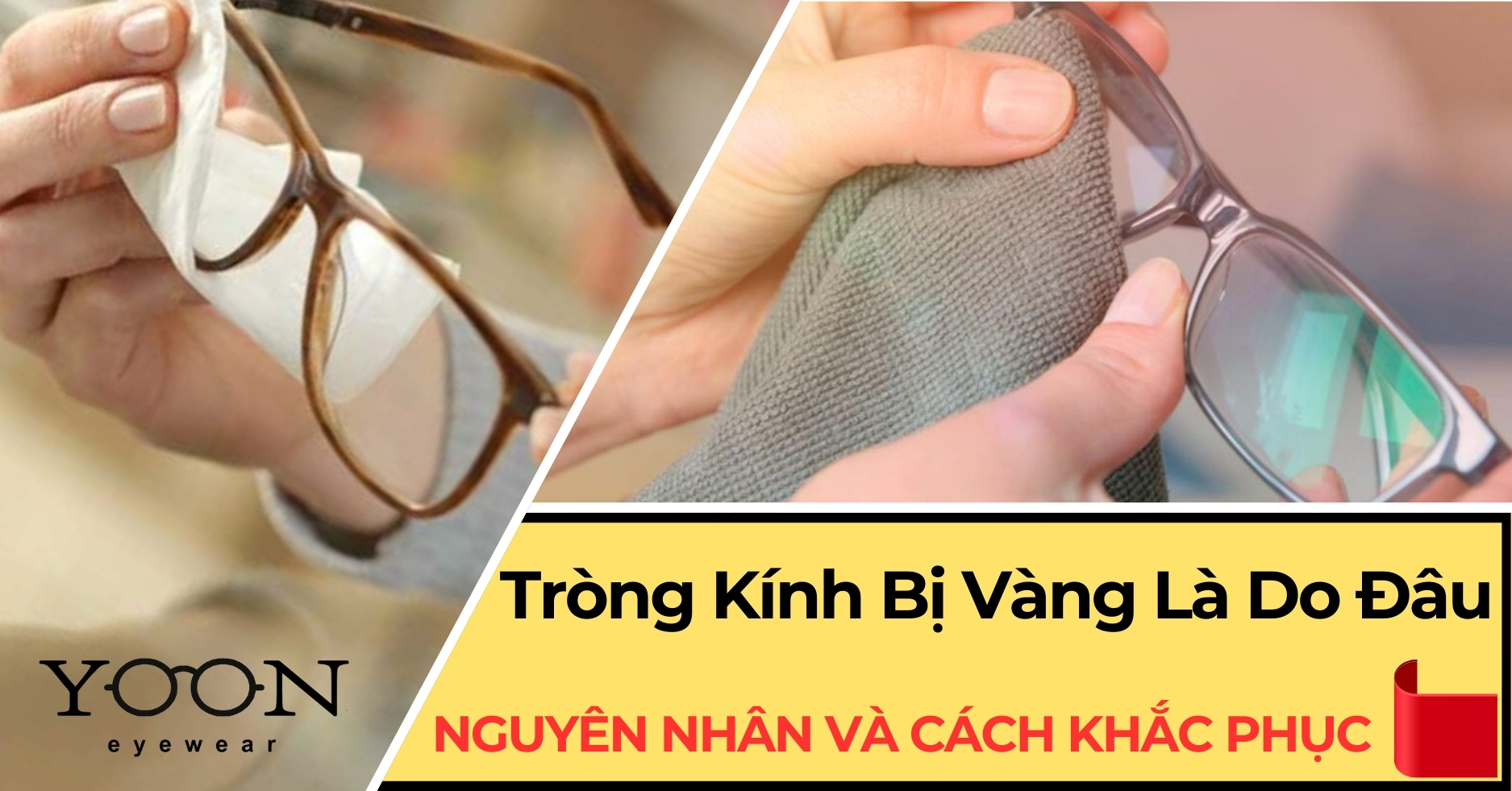 Tròng Kính Bị Vàng Là Do Đâu? Nguyên Nhân Và Cách Khắc Phục? – Mắt Kính ...